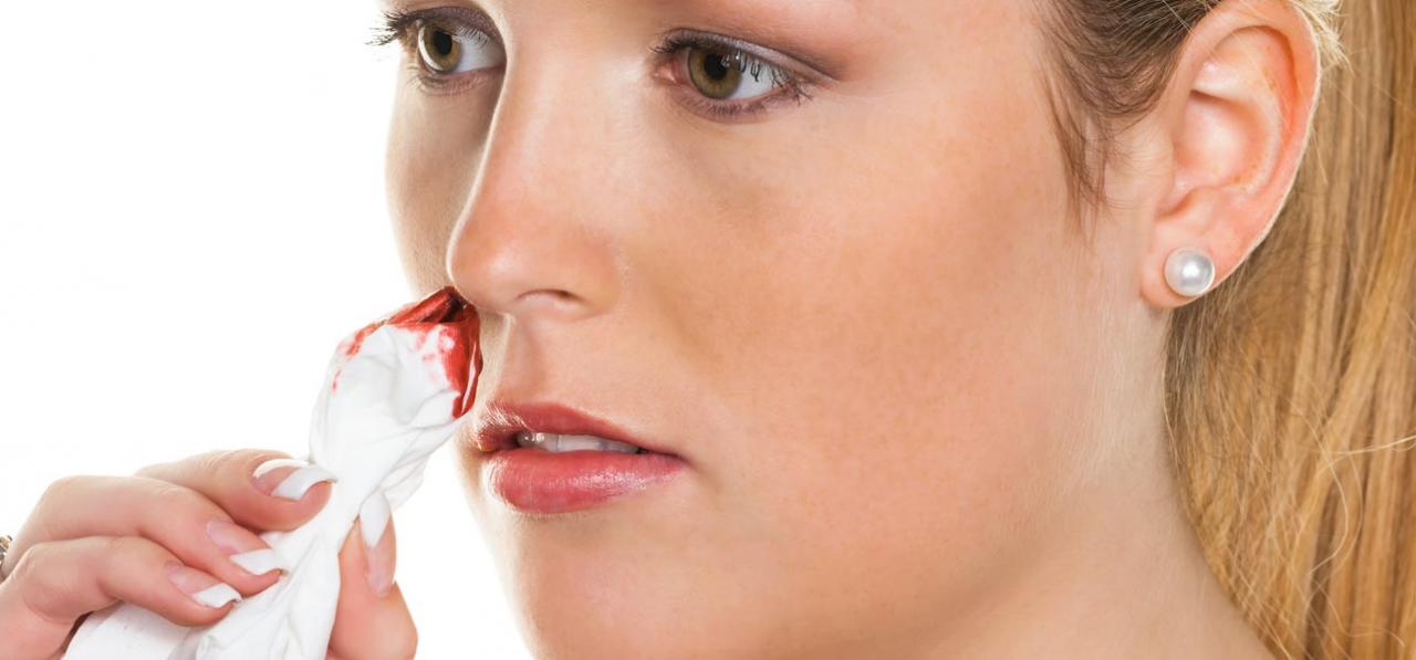 Is Blood Clots During A Nosebleed Normal Nose Bleed ion